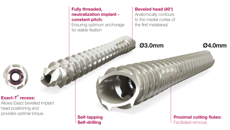 MIS Bunion Correction | Novastep International