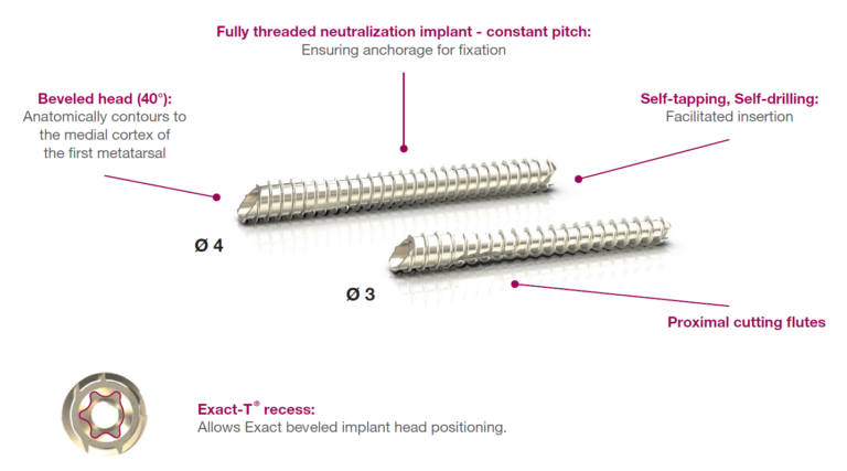 MIS Bunion Correction | Novastep International