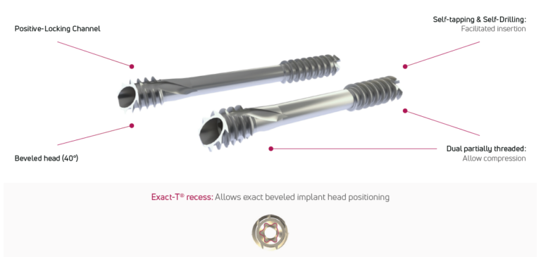 TARSOPLASTY® | Novastep International