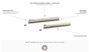 TARSOPLASTY® | Novastep International
