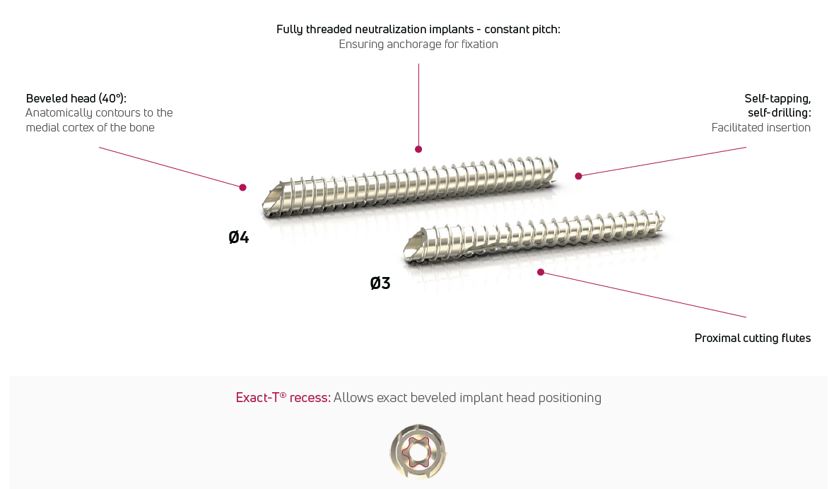 TARSOPLASTY® | Novastep International