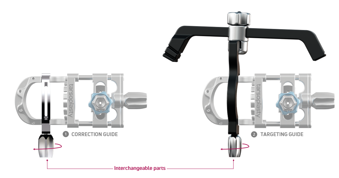TARSOPLASTY® | Novastep International