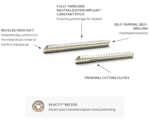 MIS Bunion Correction | Novastep International